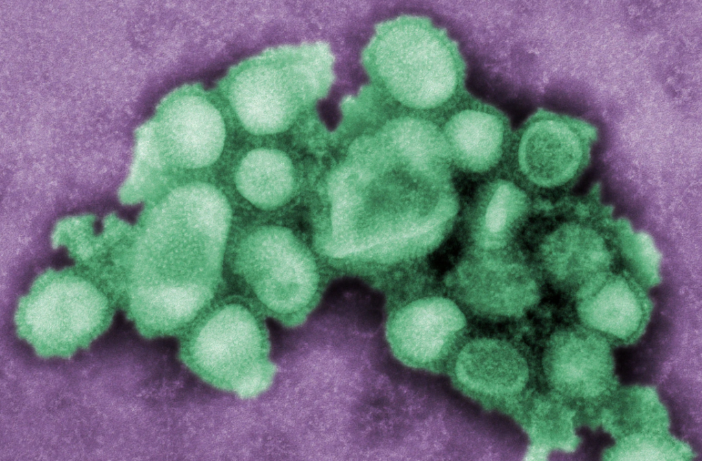 The outcome of drinking the unclean tap water - Home Senator